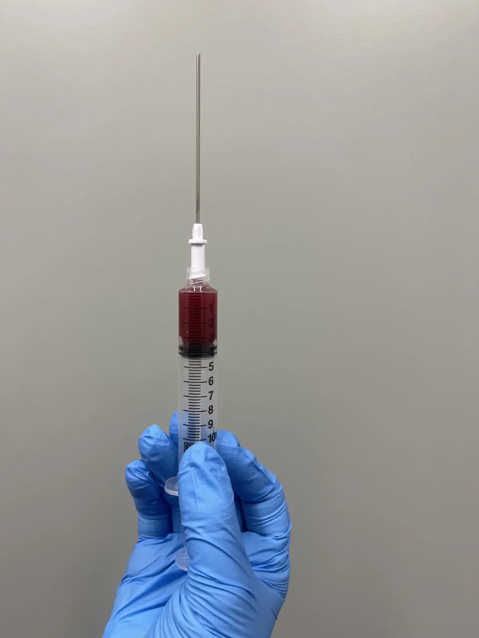 PRP ORTHO USES - Sano Specialty Care