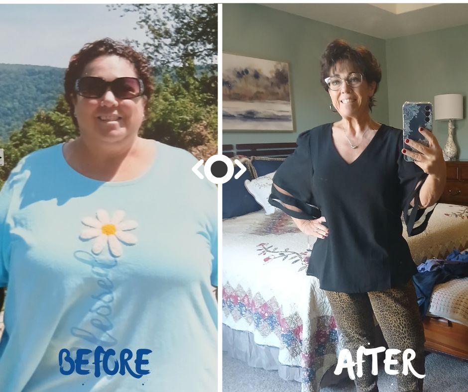 Devaun's Bariatric Surgery Success Story